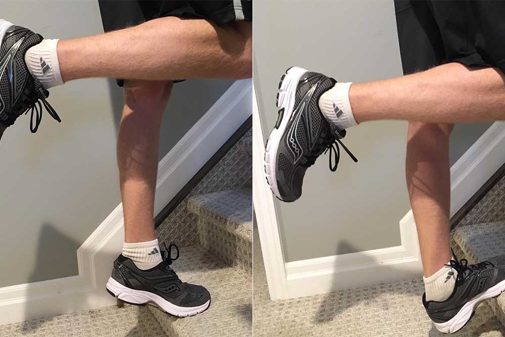 How To Treat 7 Common Running Injuries » ForeverFitScience
